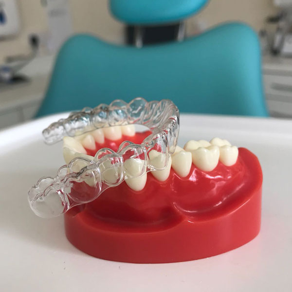 Teeth Whitening Kit – SmileCo UK